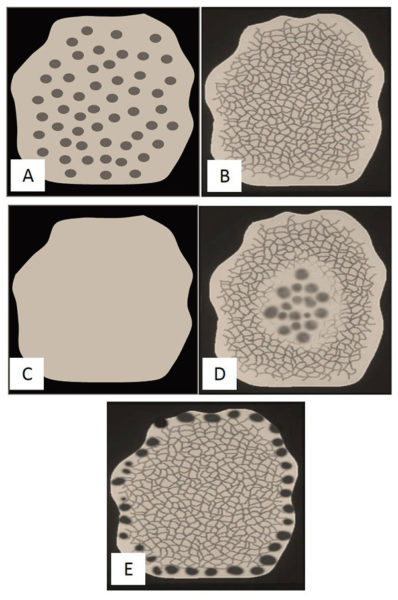 Principles for Melanoma Diagnosis Learned From the Study of Nevi in ...