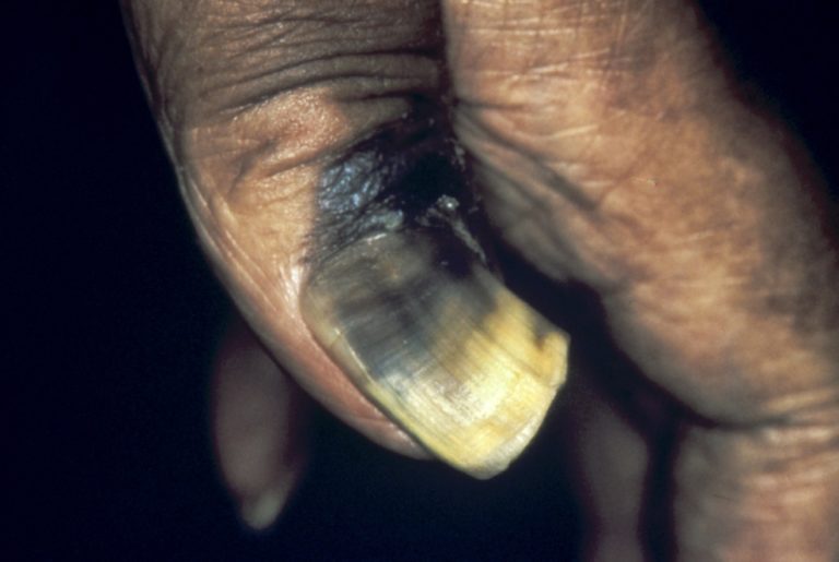 The Skin of Color Revolution in Dermatology: Crucial Lessons Learned ...